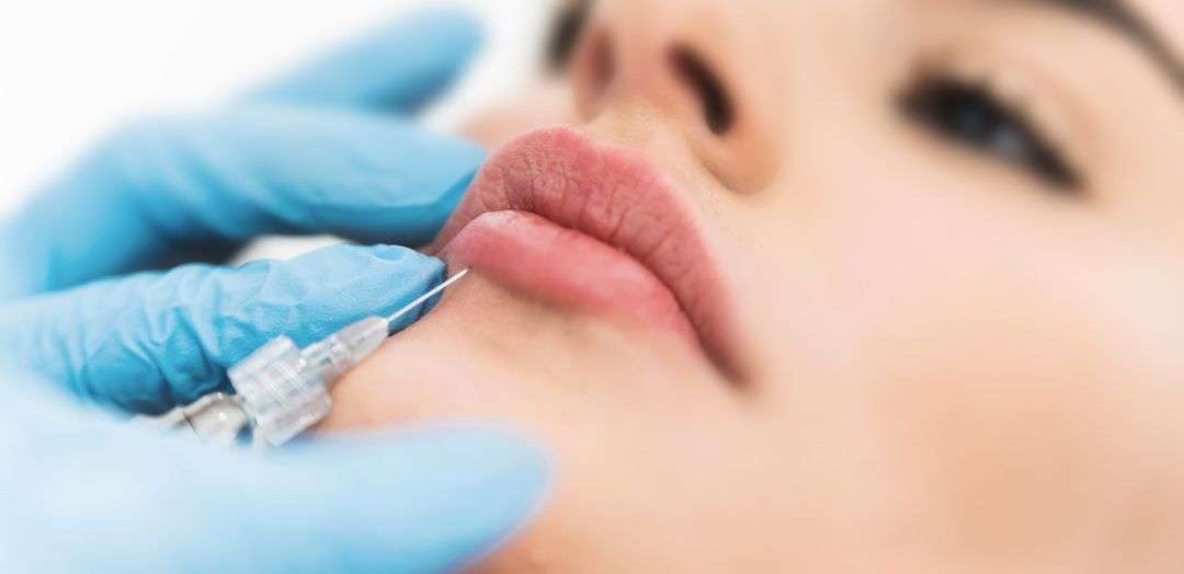 Explore Injectables Before & After - ZO Skin Centre Houston